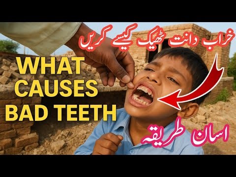 How to Fix Bad Teeth Naturally | How to Fix Bad Teeth Naturally | Easy Home Remedy 2025