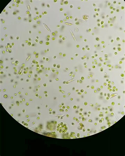 These are some little unicellular green organisms probably some algae. Look how many of them there are in a small quantity of water and image to keep the social distance. In the low center, we can see a colony of these algae. Video taken by phone on BRESSER Science Infinity Microscope (400X). #microscope #microscopy #microbenotes #scienceinfo Video Credit: @pondlife.04 | Microbe Notes