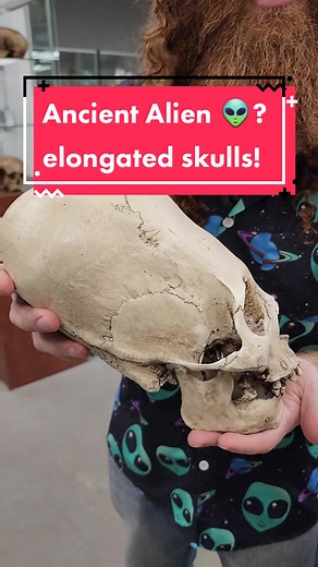 Ancient Alien?! NOPE! It's an elongated human skull! #historytiktok #historytok #antiquities #vultureculture #oddities #skulls