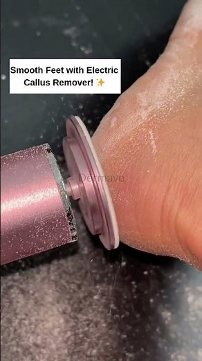 No More Cracked Heels! Discover Dermave's Electric Foot Callus Remover!