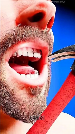 How Dentists Fix Broken Teeth 🦷 | Tooth Repair Process Explained Step by Step #shorts