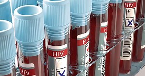 Nova variante do HIV: o que se sabe até o momento