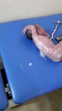 Cleaning The Baby After Birth .Please Watch Complete Video