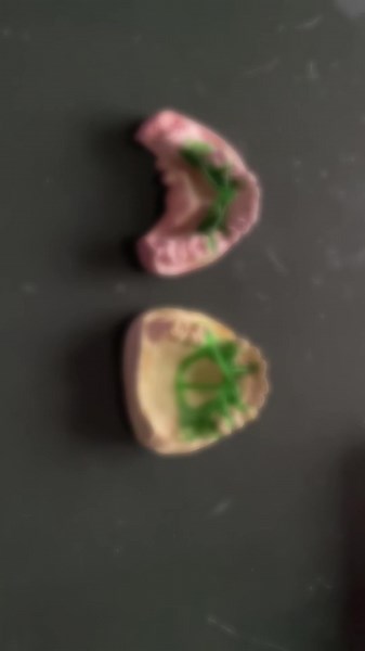 Prótesis removible Cro-Co @Dandrew @Ronnie Acosta🔥 @Steven.m180 @Cinty 🧚🏻 @#fyp #paratiiiiiiiiiiiiiiiiiiiiiiiiiiiiiii #laboratoriodental #mecanicadental #tecnicodental #tecnicodentalecuador #odontologia #rehabilitacionoral #estudiantedemecanicadental🦷 #odontonotiktok #gancho #ec #ecuador #exocad #viral_video #