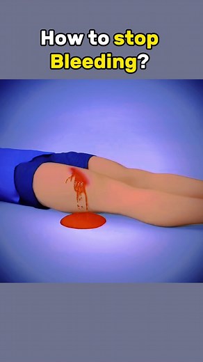 Stop Bleeding with Effective First Aid Techniques