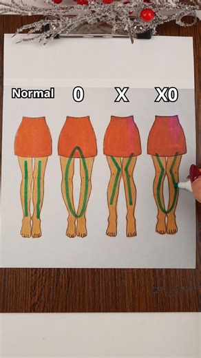 25K views · 13 reactions | Mini Dress Styles Explained This video was produced by Network Media and Aoos Media | Fix and Feast | Facebook