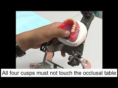 COMPLETE DENTURE: 9. Teeth Setting Up - Posterior Maxillary Teeth