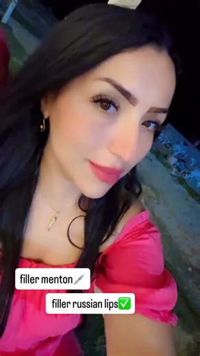 فيلر شفايف طبيعي #paratiiiiiiiiiiiiiiiiiiiiiiiiiiiiiii #tok #filler #pourtoii #skinbooster