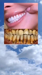 299K views · 39K reactions | The Perfect Tooth Brushing Routine: A Guide to a Healthier Smile Achieve a sparkling smile with our ultimate tooth brushing guide! 醴✨ Discover the secrets to proper brushing techniques, the best types of toothbrushes and toothpaste, and tips for maintaining oral hygiene. Watch now to ensure your teeth are as healthy as they are beautiful! #OralHygiene #HealthySmile #ToothBrushingTips | Natural Recipes | Facebook