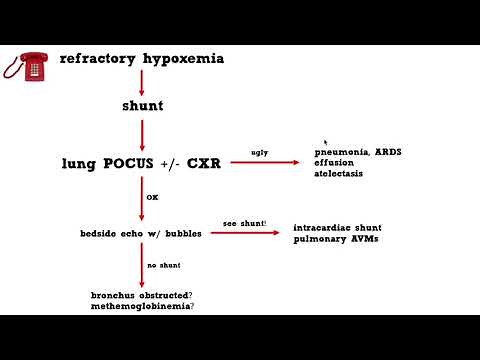 Hypoxemia physiology that's actually clinically useful