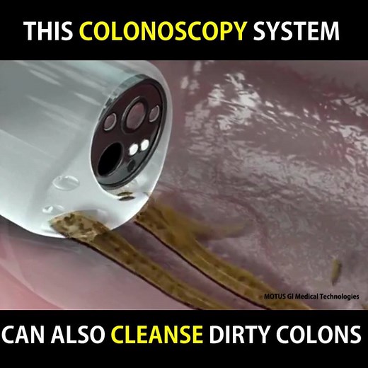 9.9M views · 35K shares | Here is a device for colonoscopy and cleansing dirty colons. | Hashem Al-Ghaili | Facebook