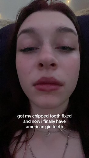 Chipped Tooth in American Girl Doll | Fixing & Replacement Tips