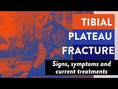 Tibial plateau fracture: Signs, symptoms and current treatments