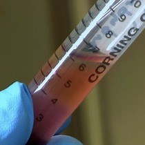 Video: Quantitative In vitro Assay to Measure Neutrophil Adhesion to Activated Primary Human Microvascular Endothelial Cells under Static Conditions