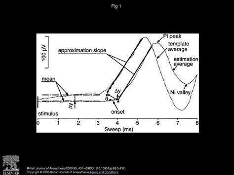 somatosensory evoked potentials for closed loop control of anaesthetic depth using propofol in