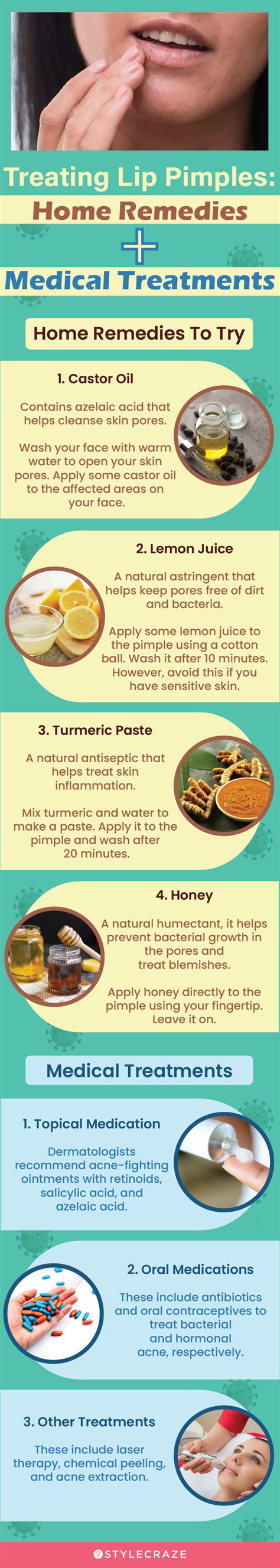 How To Get Rid Of Pimple On Lip Line