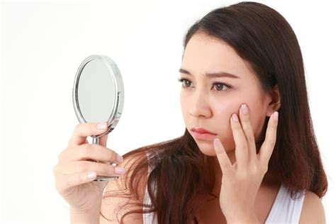 Dry Skin Patches Causes And Treatments I The Moms Co