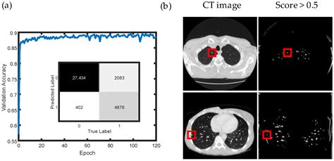 life free full text pulmonary nodule detection and classification using all optical deep