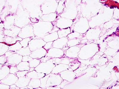 Adipose Tissue Histology Adipose Tissue Histology Slide
