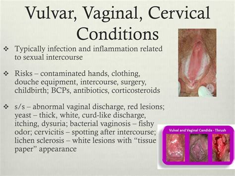 Ppt Female Reproductive Disorders Powerpoint Presentation Free Download Id1535658
