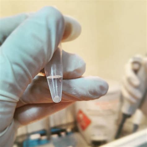 This Is DNA Visible To The Naked Eye You Are Seeing Both DNA And RNA