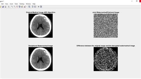joint encryption watermarking system using aes and rc4 for medical image youtube