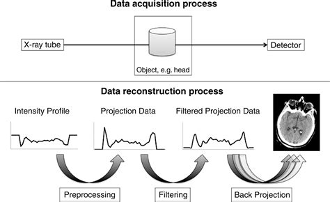 state of the art iterative ct reconstruction techniques radiology