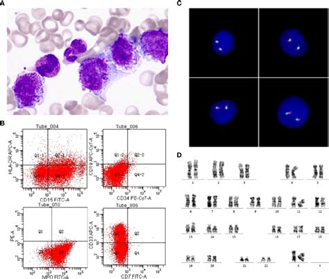 Frontiers Case Report A Rare Case Of TBL1XR1 RARB Positive Acute