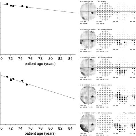 pdf a visual field index for calculation of glaucoma rate of progression