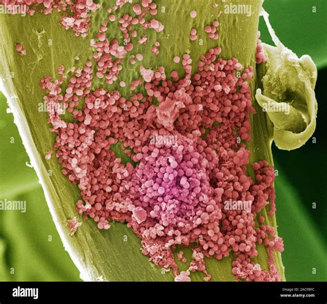 MRSA Bacteria Coloured Scanning Electron Micrograph SEM Methicillin