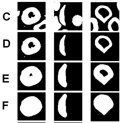 erythrocytes segmentation method a original image b conversion to download scientific