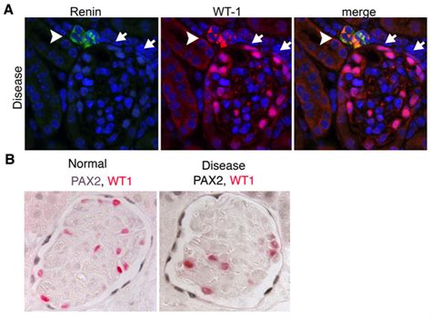 Renin Producing Vascular Smooth Muscle Cells Activate WT1 And PECs