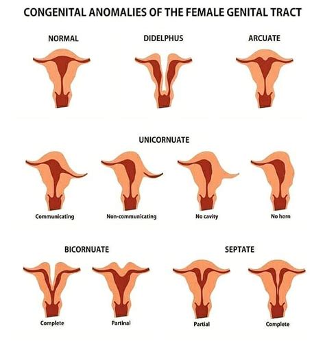 Female Genital Tract In 2021 Nursing Notes Medical Ultrasound