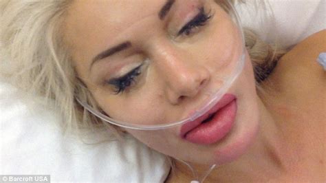 Model Pixee Fox Has 15 Surgeries And 6 RIBS Removed To Look Like