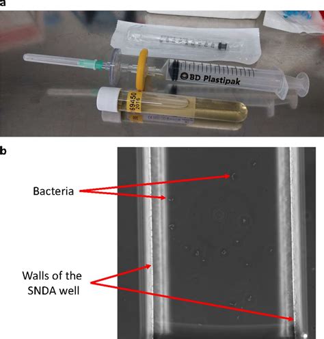 Rapid Phenotypic Antimicrobial Susceptibility Testing Using Nanoliter