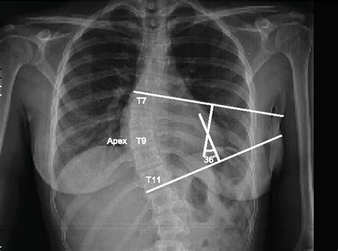 figure 1 from flexible retrieval of x ray images based on shape descriptors using a fuzzy object