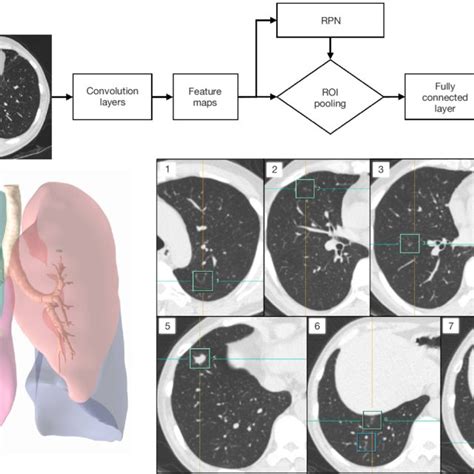 the framework of the deep learning powered pulmonary nodule detection download scientific