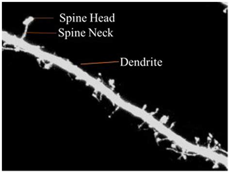 morphological analysis of dendrites and spines by hybridization of ridge detection with twin