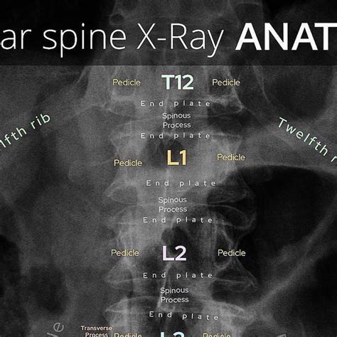 The Radiologist Radiology On Instagram Read On To Learn A System To