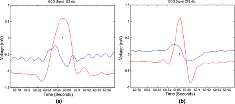 a new fuzzy learning vector quantization method for classification problems based on a granular