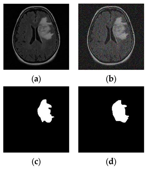 diagnostics free full text brain tumor class detection in flair t2 modality mri slices using