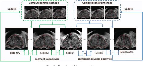 figure 2 from three dimensional prostate segmentation using level set with shape constraint