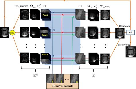 correction of gradient nonlinearity artifacts in prospective motion correction for 7t mri