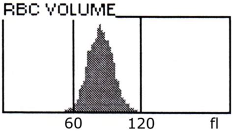 Histogramm Des Erythrozytenvolumens DocCheck