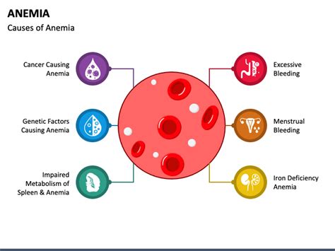 Free Anemia PowerPoint And Google Slides Template PPT Slides
