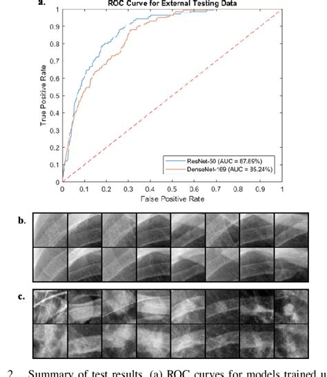 [pdf] unsupervised detection of lung nodules in chest radiography using generative adversarial