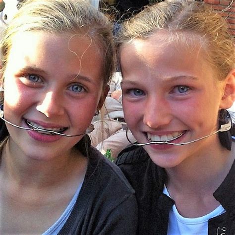 Pin Oleh Singsing Di Braces Girls