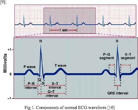 figure 1 from performance analysis of adaptive filtering algorithms for denoising of ecg signals
