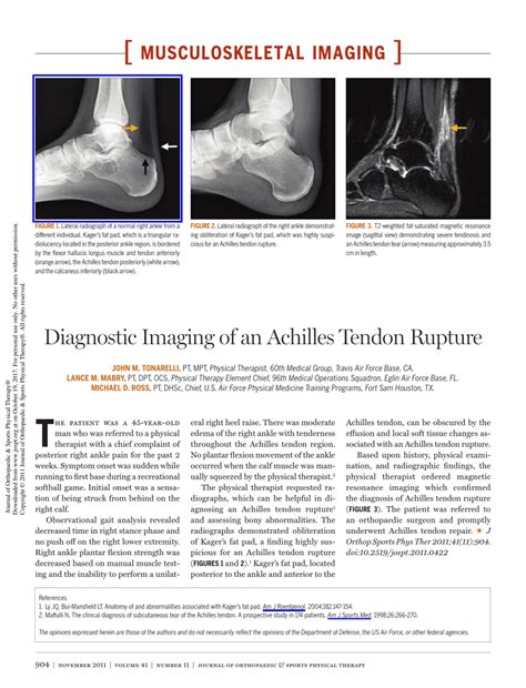 Pdf Diagnostic Imaging Of An Achilles Tendon Rupture
