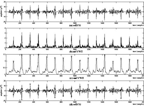 wavelet analysis and candidate fetal r peak detection a seecg download scientific diagram